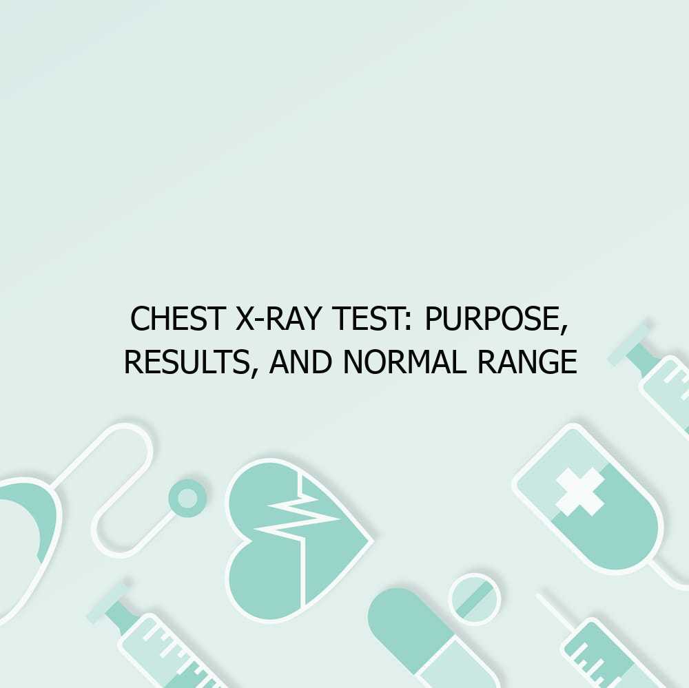 Chest X-ray Test: Purpose, Results, and Normal Range Chest X-ray Test: Purpose, Results, and Normal Range